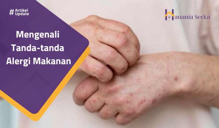 Mengenali Tanda-tanda Alergi Makanan | Hanania Serka