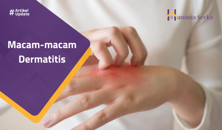 Macam-macam Dermatitis | Hanania Serka