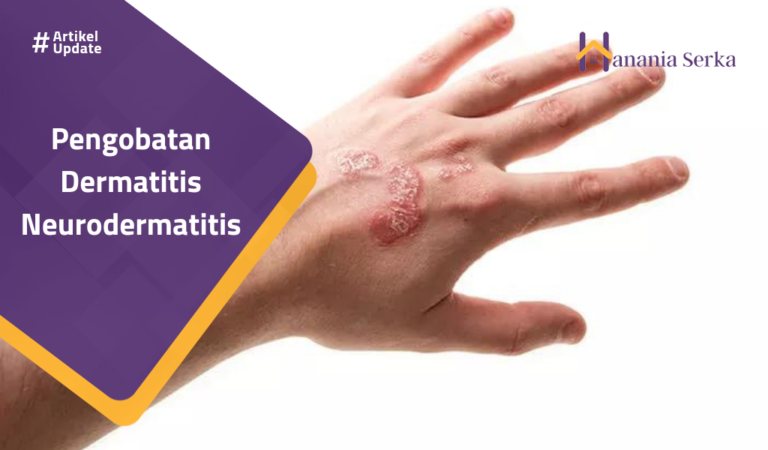 Pengobatan Dermatitis Neurodermatitis | Hanania Serka
