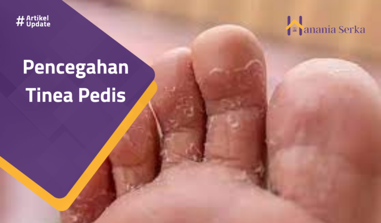 Pencegahan Tinea Pedis | Hanania Serka