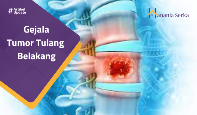 Gejala Tumor Tulang Belakang | Hanania Serka