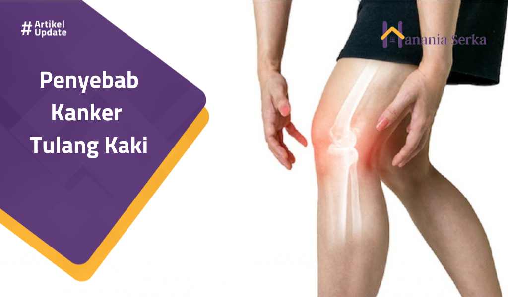 Penyebab Kanker Tulang Kaki | Hanania Serka