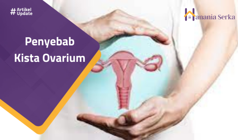 Penyebab Kista Ovarium | Hanania Serka