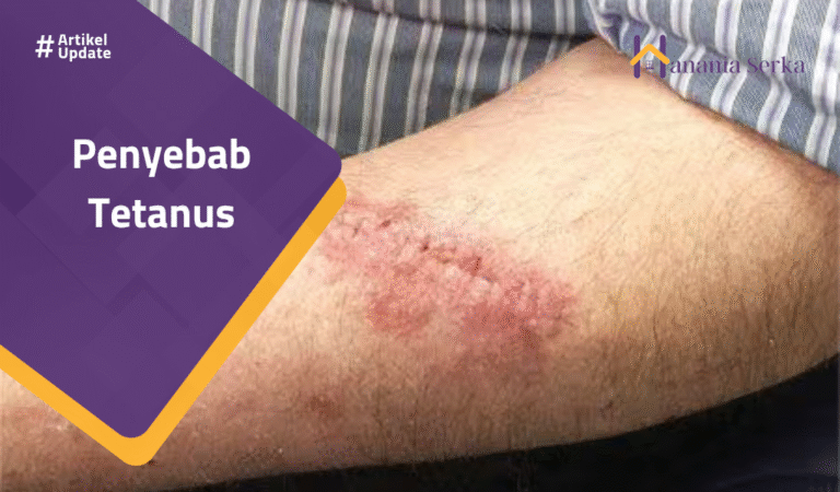 Penyebab Tetanus | Hanania Serka