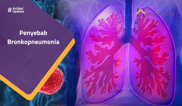 Penyebab Bronkopneumonia | Hanania Serka